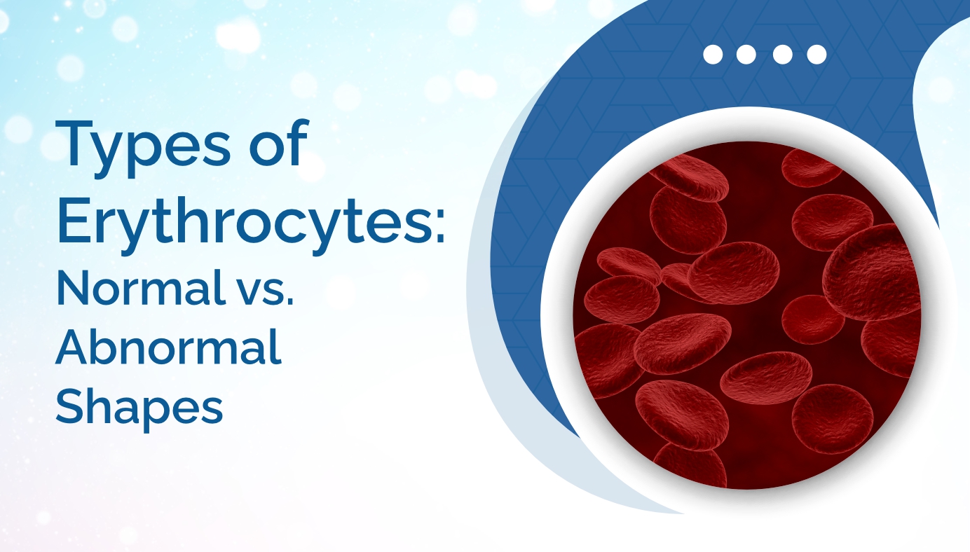 AMPATH Lab: Types Of Erythrocytes Normal Vs Abnormal Shapes